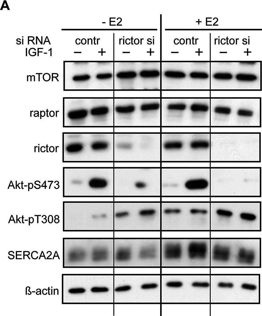 Rictor Antibody (NB100-612) | Bio-Techne