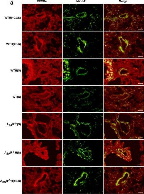 CXCR4 Antibody (NB100-74396) | Bio-Techne