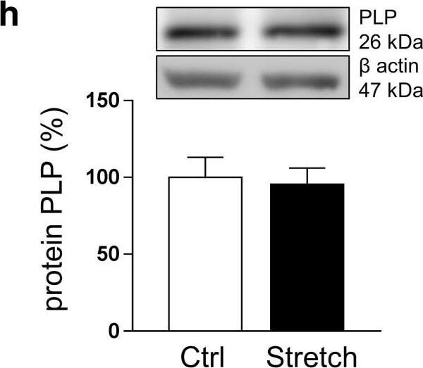Myelin PLP Antibody (NB100-74503) | Bio-Techne