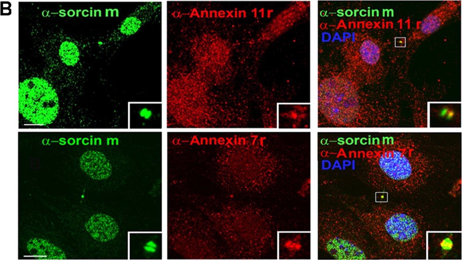 Annexin A11 Antibody (NB100-78588) | Bio-Techne