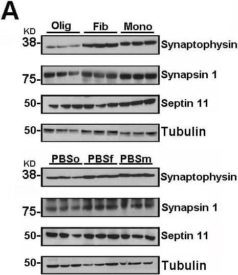 Synapsin I Antibody (NB300-104) | Bio-Techne