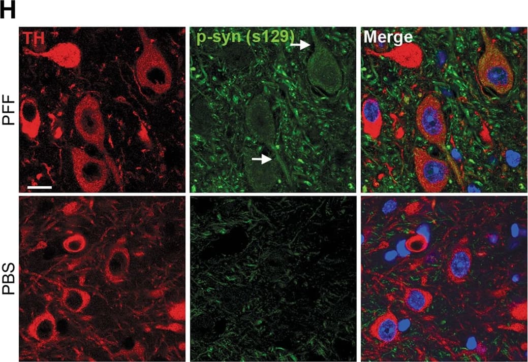 Tyrosine Hydroxylase Antibody (NB300-110) | Bio-Techne