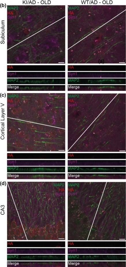 MAP2 Antibody (NB300-213) | Bio-Techne