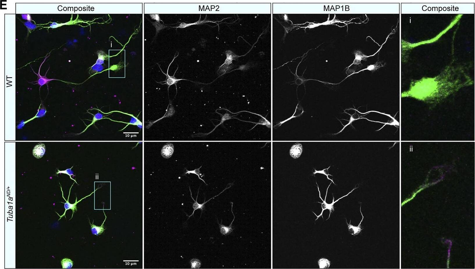 MAP2 Antibody (NB300-213) | Bio-Techne