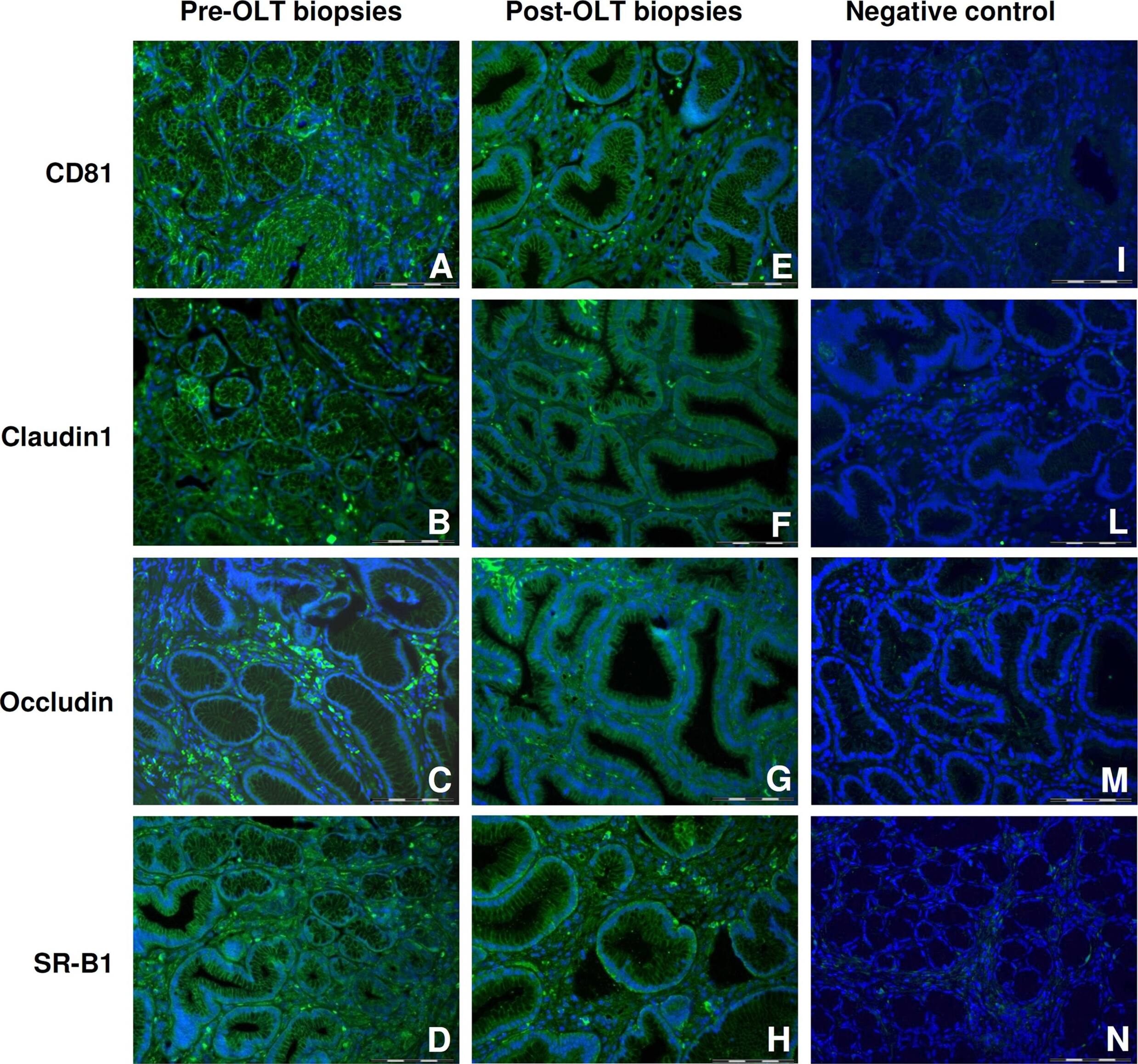 SR-BI Antibody - BSA Free (NB400-104) | Bio-Techne