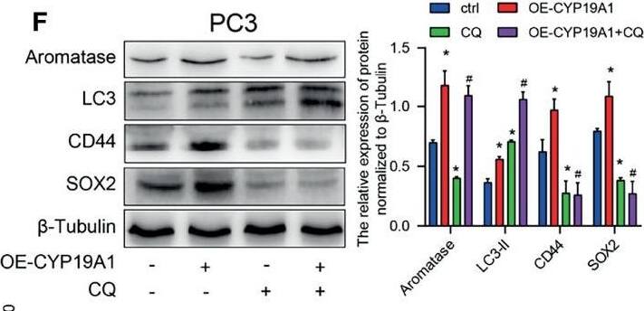 LC3B Antibody - BSA Free (NB600-1384) | Bio-Techne