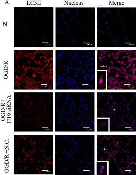 LC3B Antibody - BSA Free (NB600-1384) | Bio-Techne