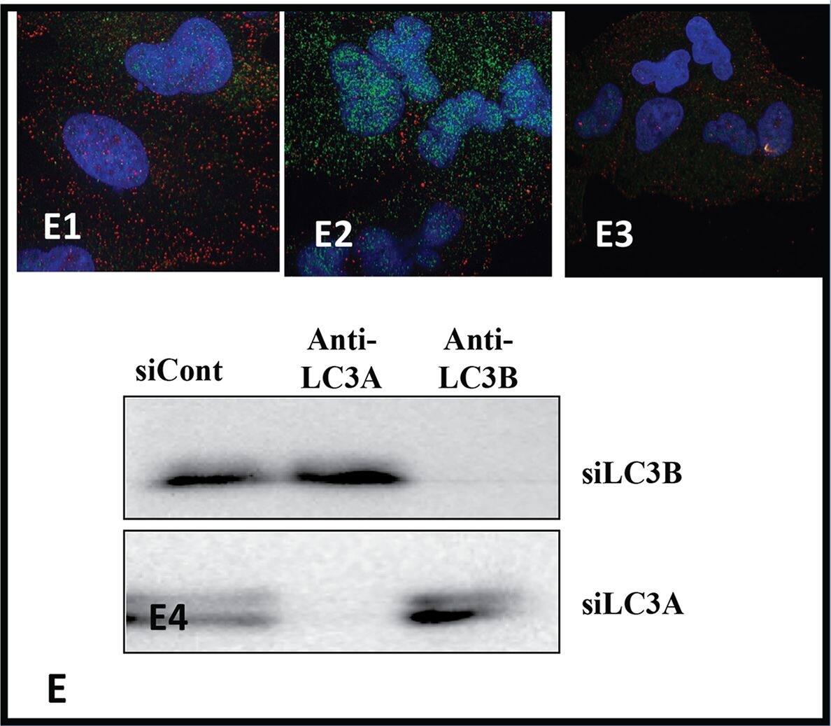 LC3B Antibody - BSA Free (NB600-1384) | Bio-Techne