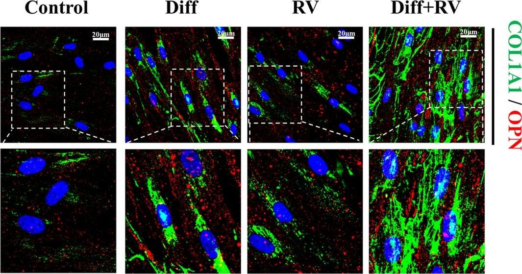 Collagen I Antibody (NB600-408) | Bio-Techne