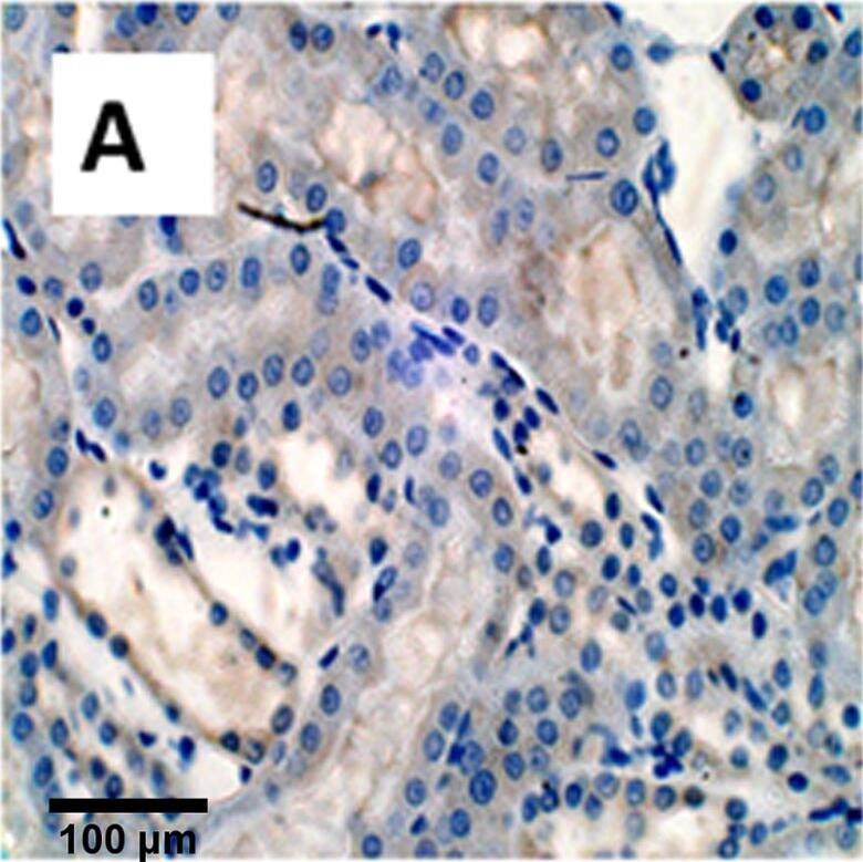 Collagen I Antibody (NB600-408) | Bio-Techne