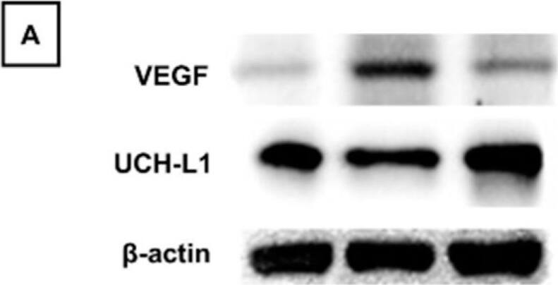 beta-Actin Antibody (AC-15) (NB600-501) | Bio-Techne
