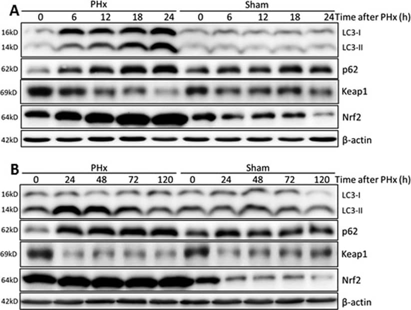 beta-Actin Antibody (AC-15) (NB600-501) | Bio-Techne
