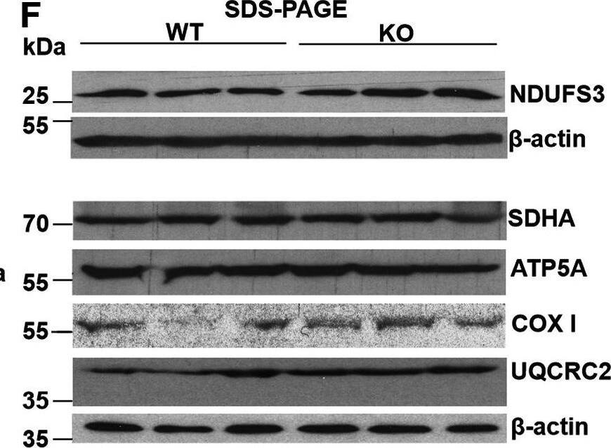 beta-Actin Antibody (AC-15) (NB600-501) | Bio-Techne