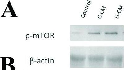 TOR/mTOR [p Ser2448] Antibody (NB600-607) | Bio-Techne