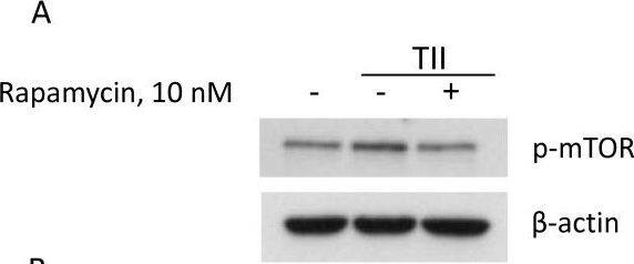 TOR/mTOR [p Ser2448] Antibody (NB600-607) | Bio-Techne