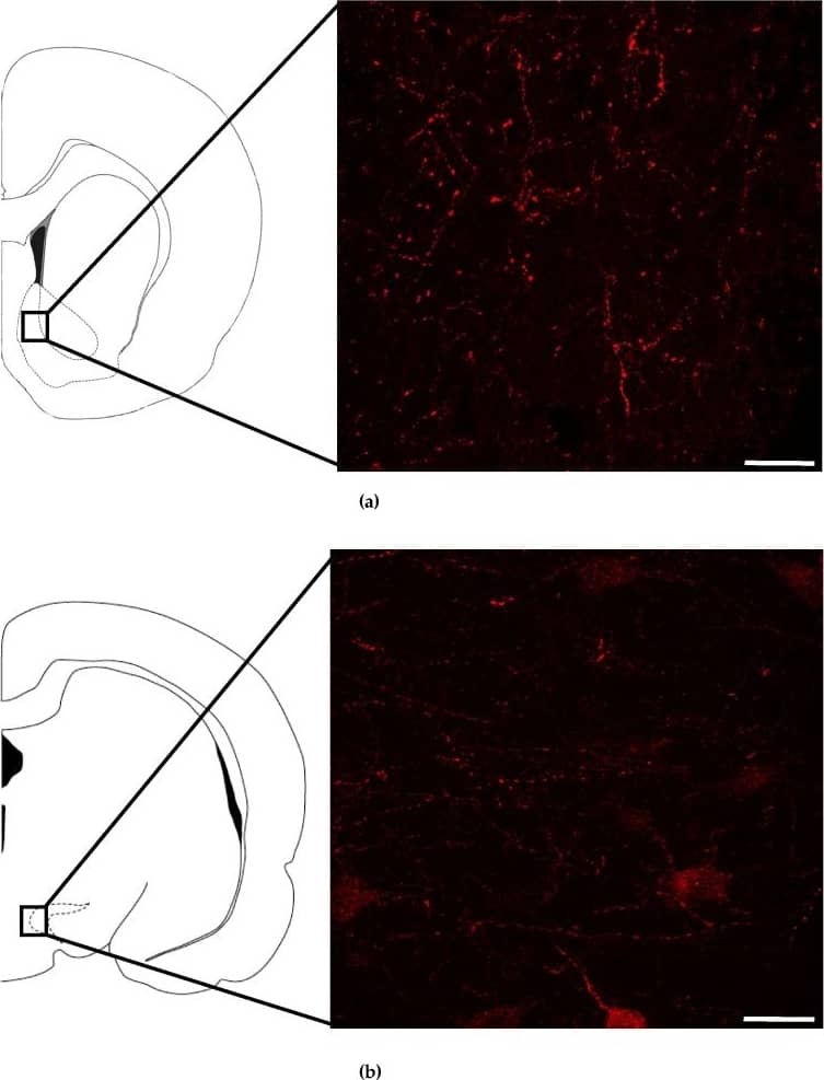 Neuromedin UR2/NMUR2 Antibody - BSA Free (NBP1-02351) by Novus, Part of ...