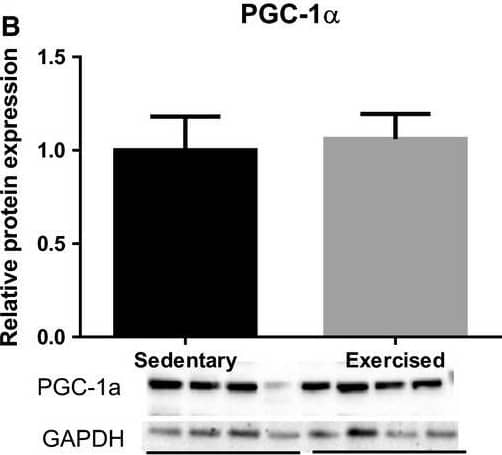 PGC1 alpha Antibody - BSA Free (NBP1-04676) by Novus, Part of Bio-Techne