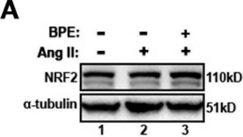 Nrf2 Antibody (NBP1-32822) | Bio-Techne