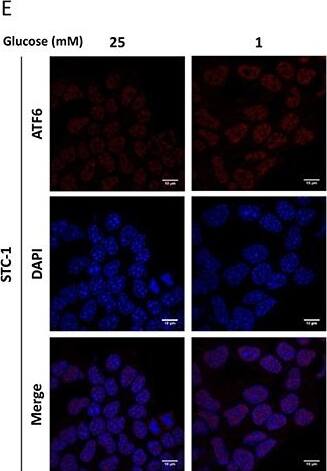 ATF6 Antibody (70B1413.1) - BSA Free (NBP1-40256) | Bio-Techne