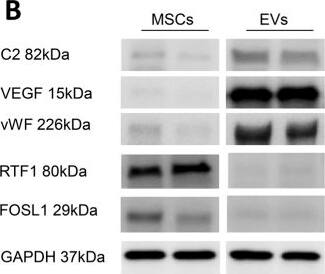 Complement Component C2 Antibody (NBP1-58985) | Bio-Techne