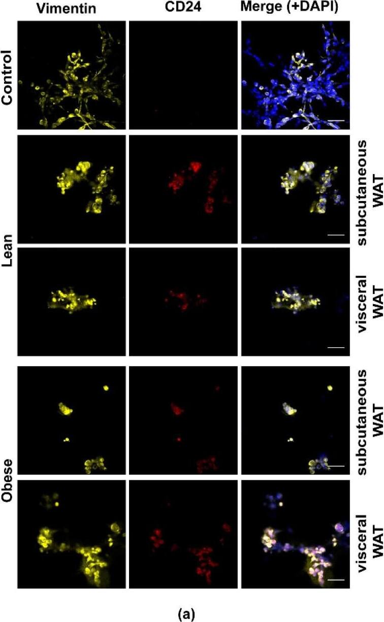 Donkey anti-Mouse IgG (H+L) Secondary Antibody [DyLight 594] (Pre ...