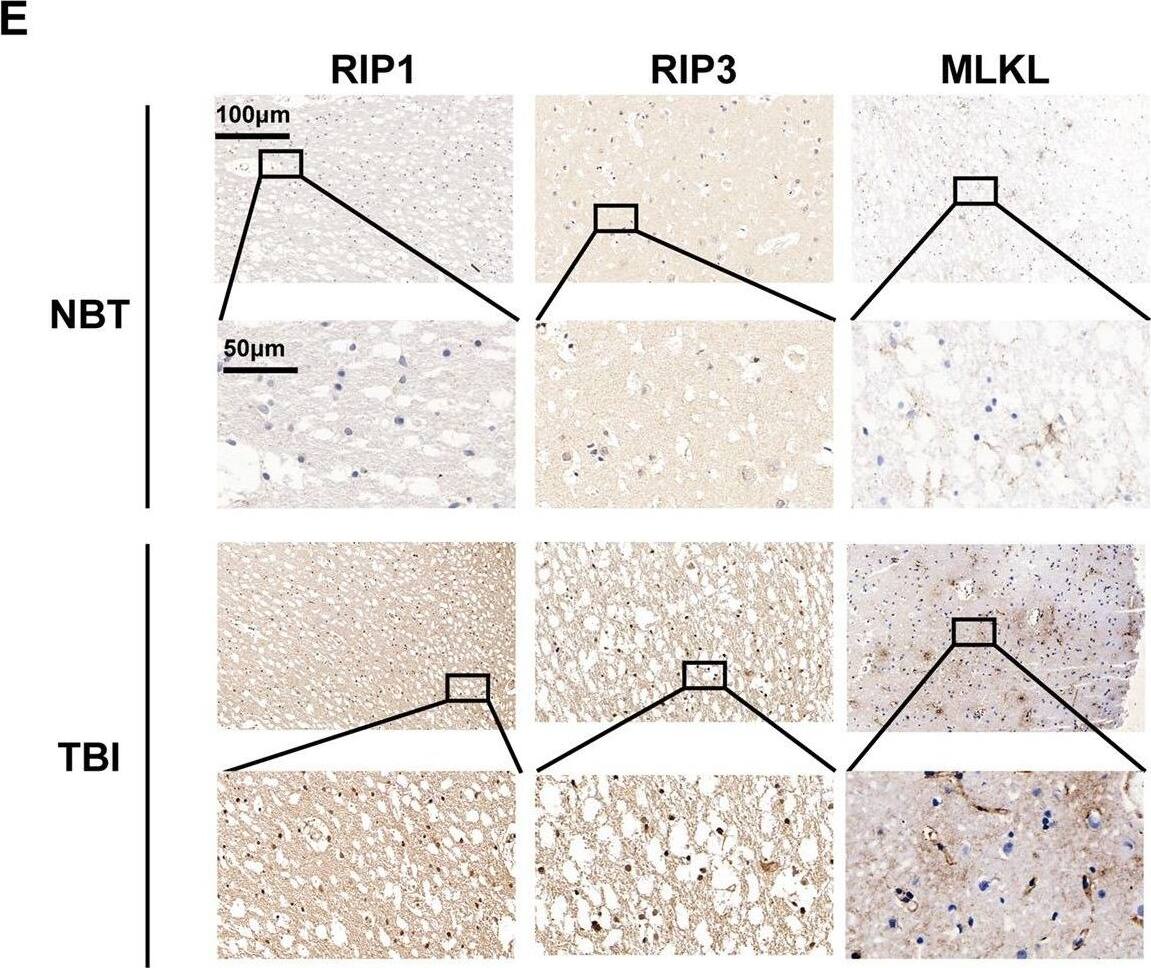 RIPK1/RIP1 Antibody - BSA Free (NBP1-77077) | Bio-Techne