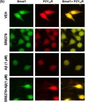 P2Y12/P2RY12 Antibody (NBP1-78249) | Bio-Techne