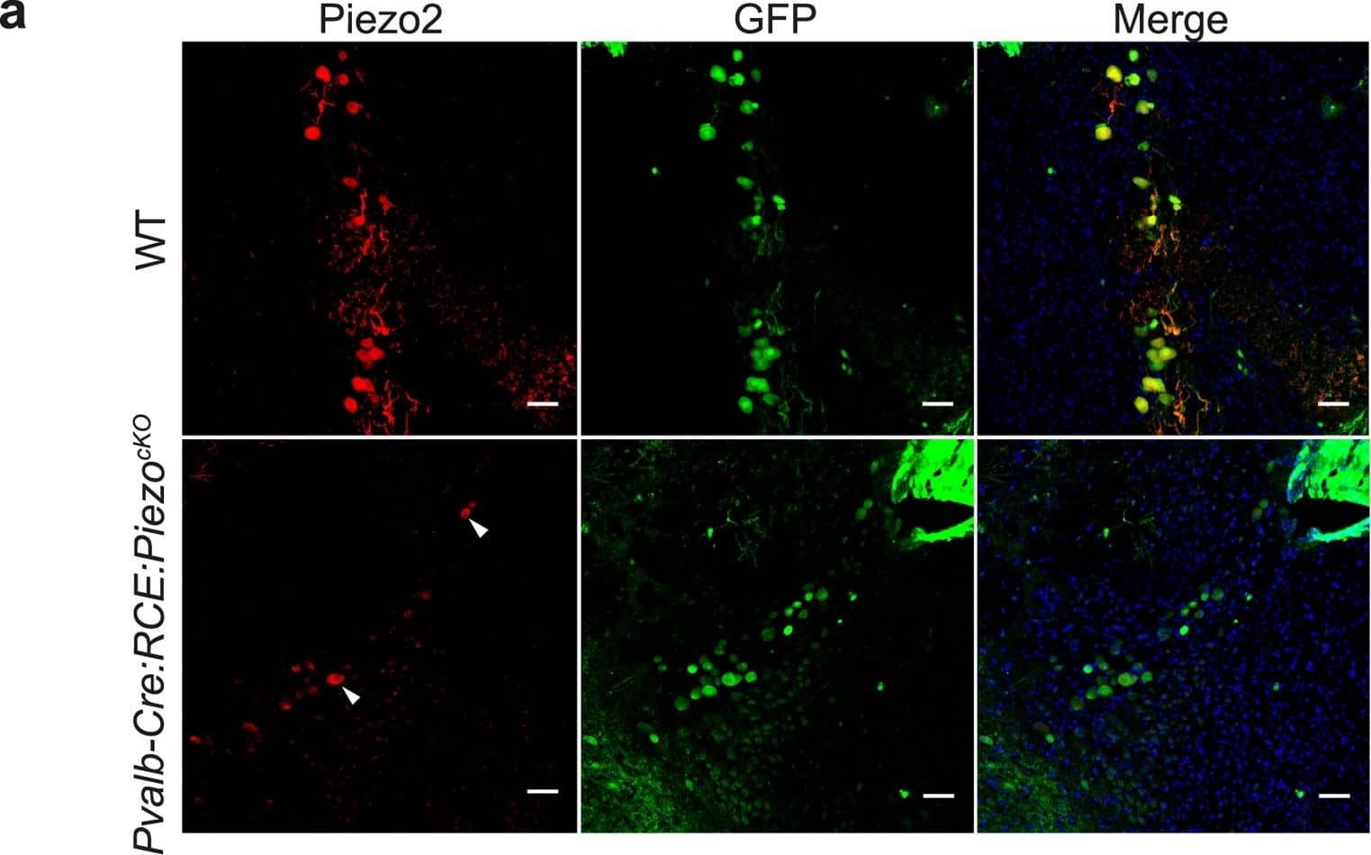 PIEZO2 Antibody - BSA Free (NBP1-78624) | Bio-Techne