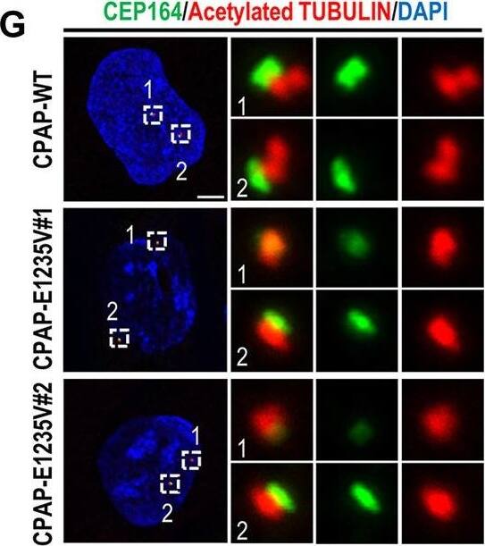 CEP164 Antibody (NBP1-81445) | Bio-Techne