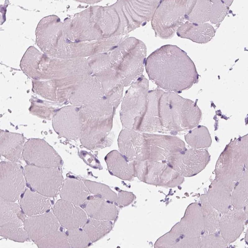 PRAME Antibody (NBP1-85418) | Bio-Techne