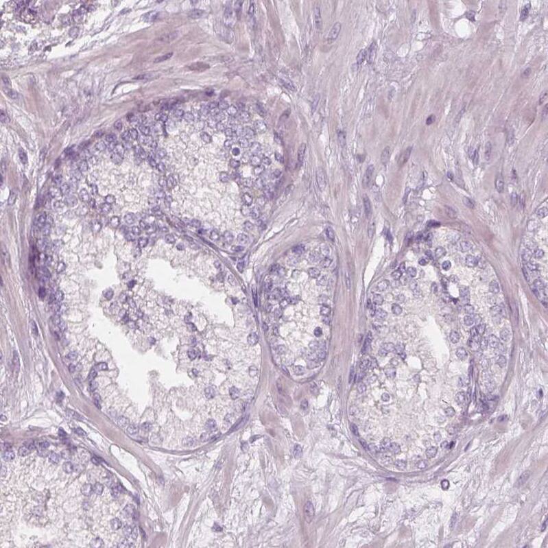PRAME Antibody (NBP1-85418) | Bio-Techne