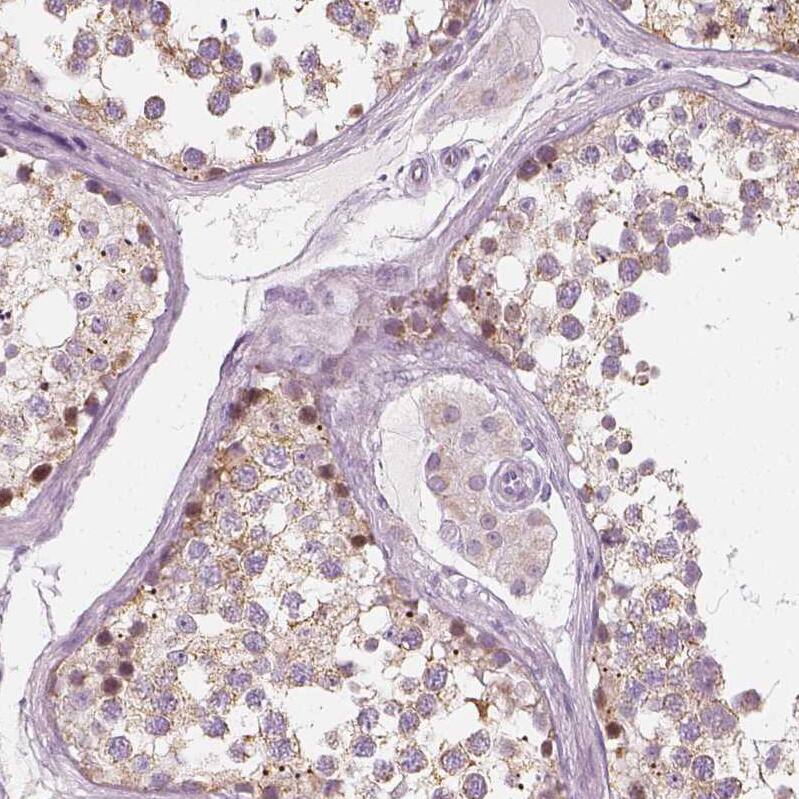 PRAME Antibody (NBP1-85418) | Bio-Techne