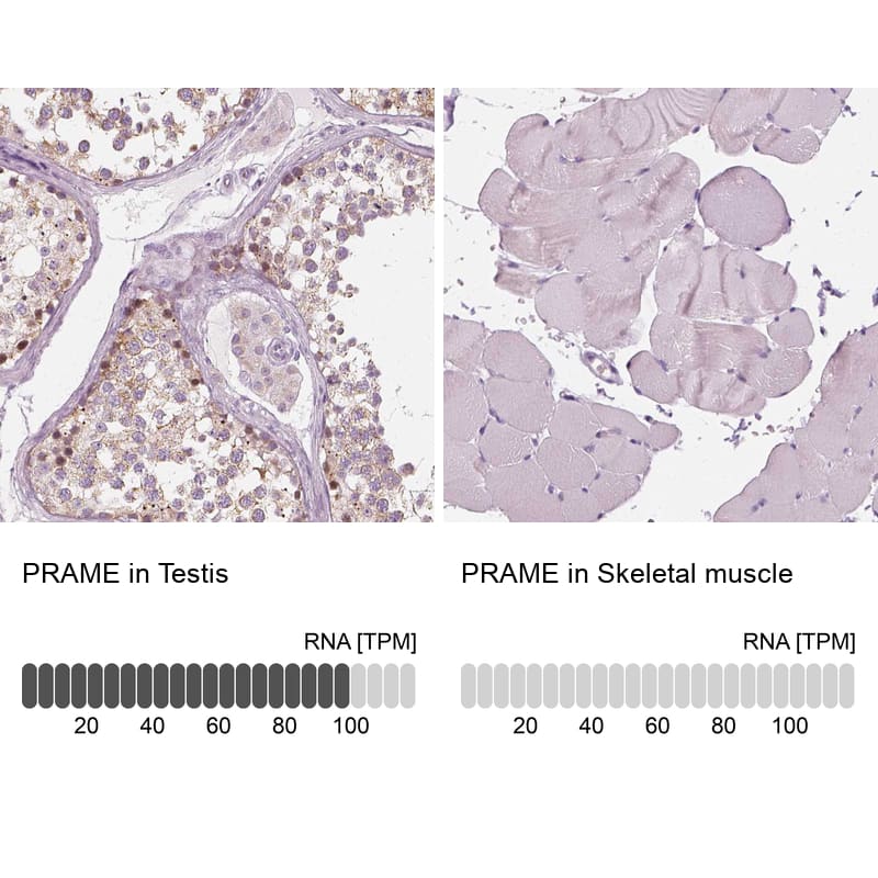 PRAME Antibody (NBP1-85418) | Bio-Techne