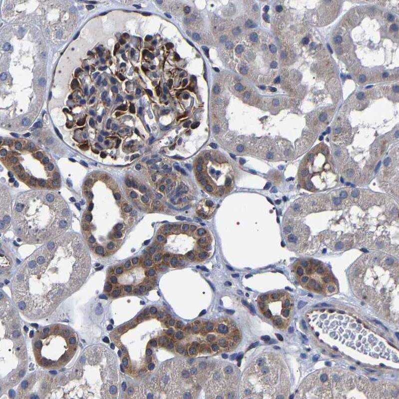 DARS Antibody - BSA Free (NBP1-86027) by Novus, Part of Bio-Techne