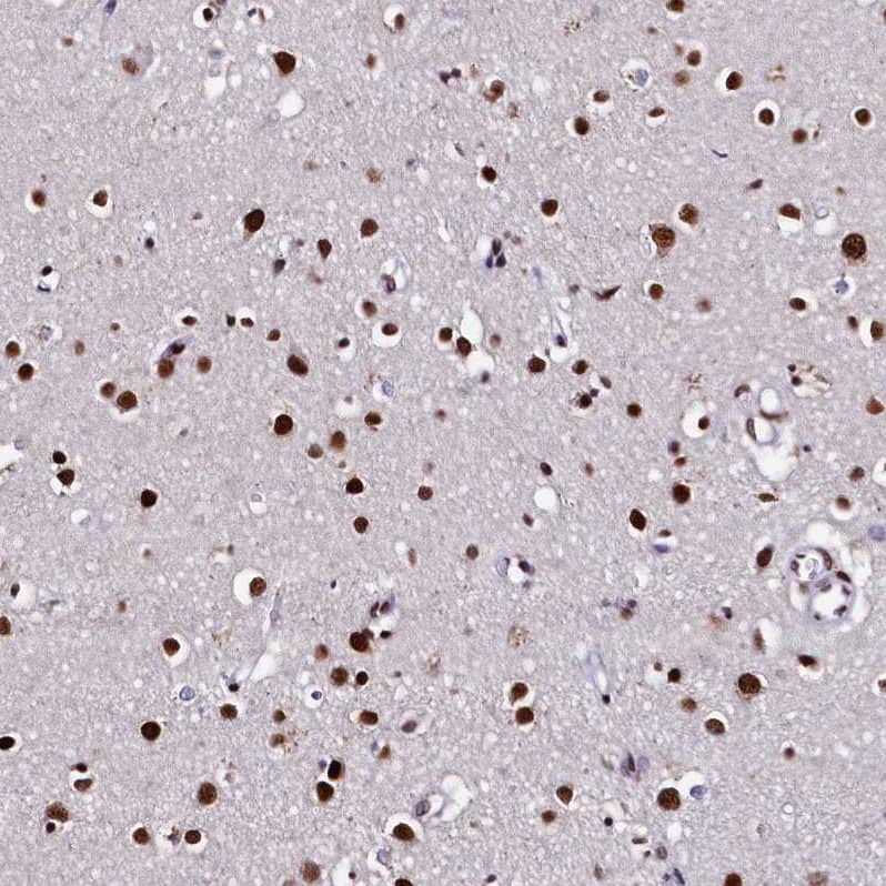 pre-mRNA cleavage factor I (59 kDa subunit) Antibody - BSA Free (NBP1 ...
