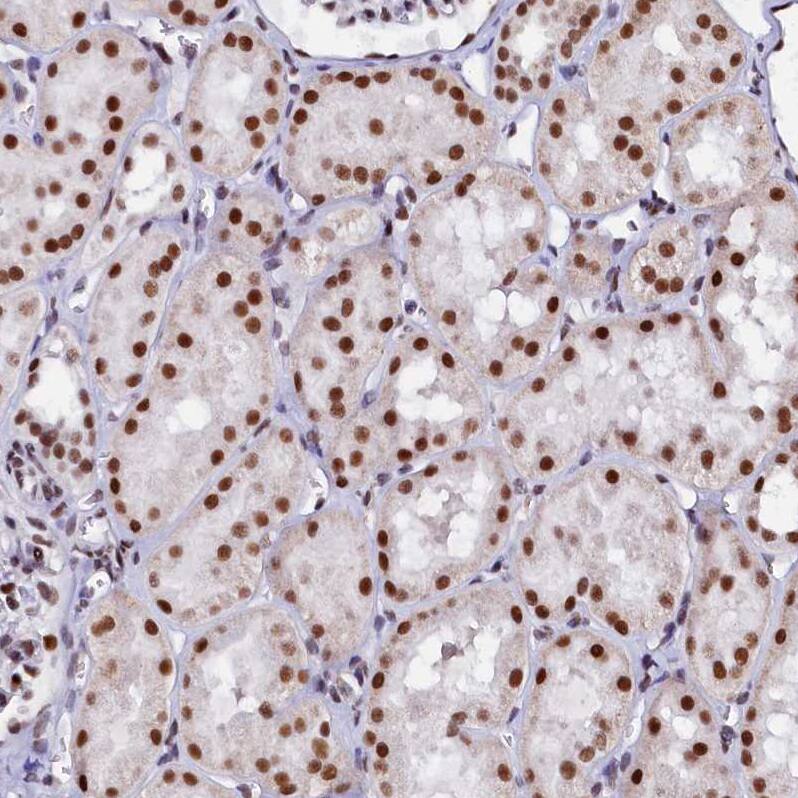 pre-mRNA cleavage factor I (59 kDa subunit) Antibody - BSA Free (NBP1 ...