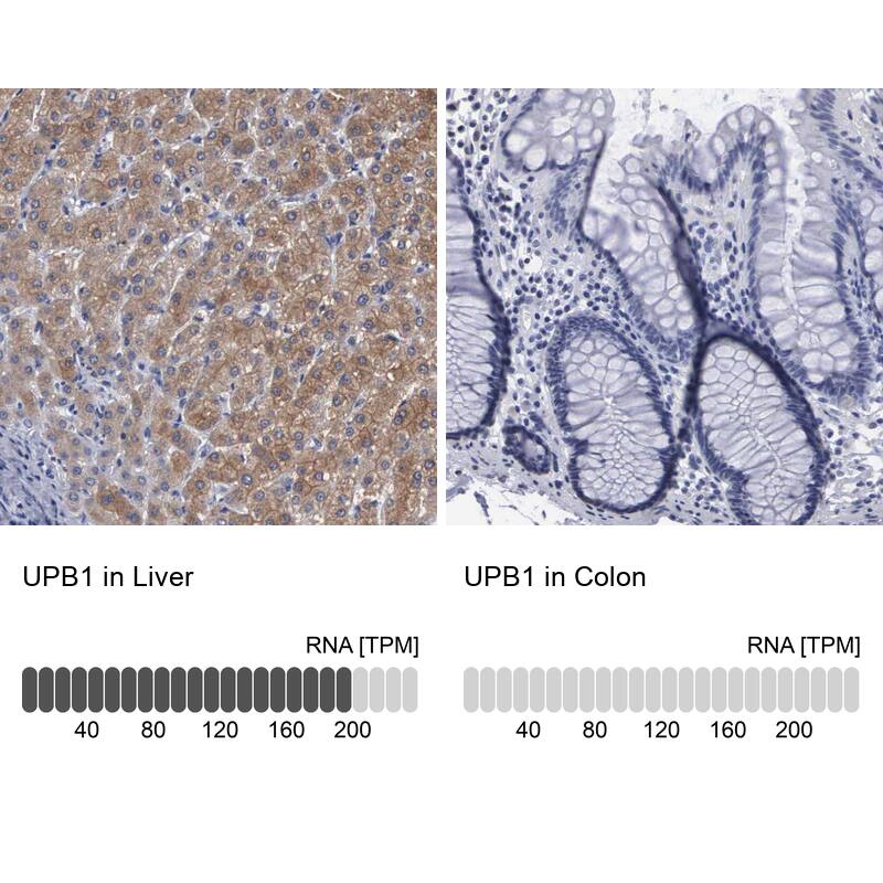 beta ureidopropionase Antibody - BSA Free (NBP1-89918) by Novus, Part ...
