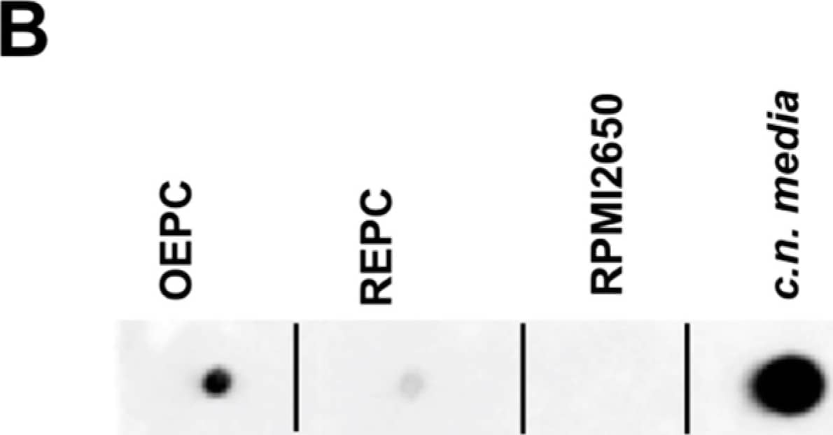 MUC5AC Antibody (45M1) (NBP2-15196) | Bio-Techne