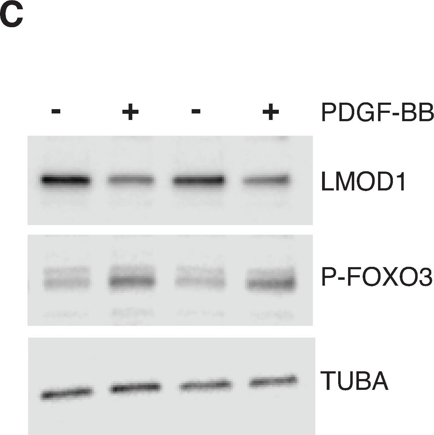 FOXO3 Antibody (NBP2-16521) | Bio-Techne