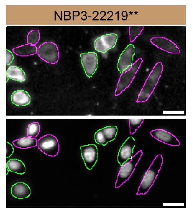 Casein Kinase 1 alpha Antibody (SR1581) - BSA Free (NBP3-22219) by ...