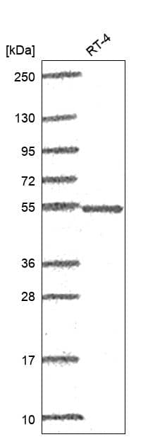 POLG2 Antibody (NBP3-25059) by Novus, Part of Bio-Techne