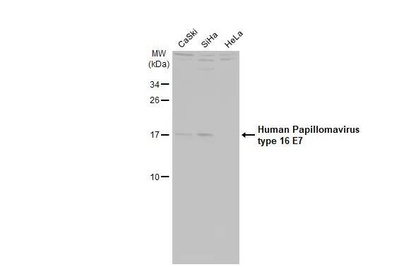 HPV16 E7 Antibody (HL1821) - Azide and BSA Free (NBP3-25511) by Novus ...