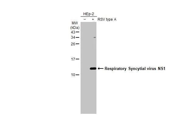 Respiratory Syncytial Virus NS1 Products