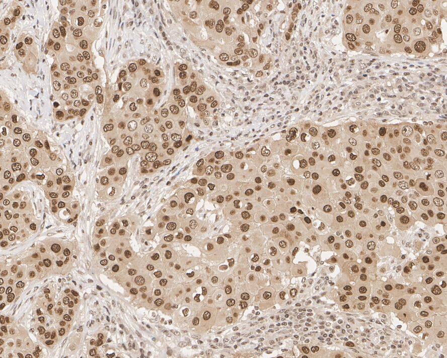 Lactyl-Lysine Antibody (PSH03-73) (NBP3-33149) by Novus, Part of Bio-Techne