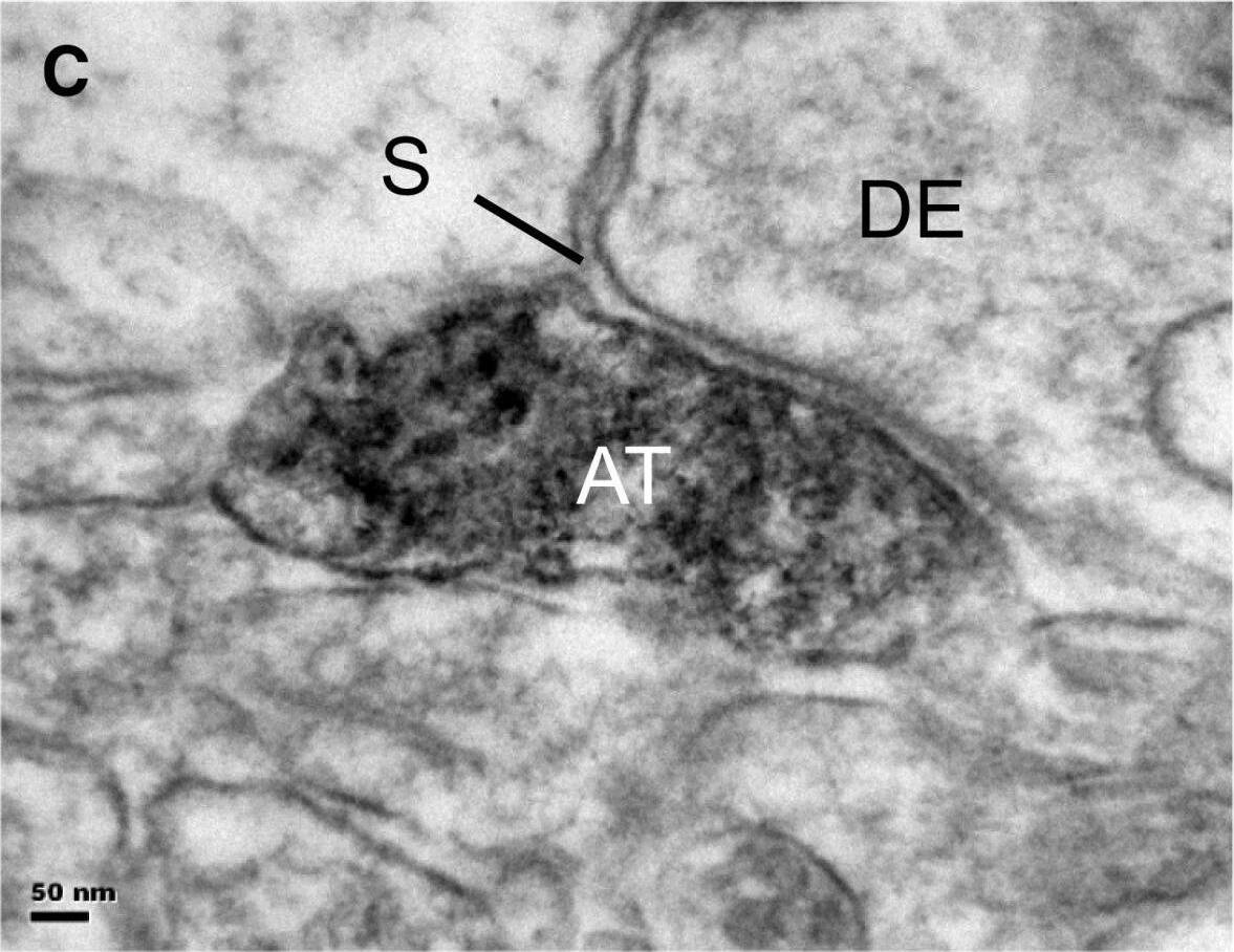 FPRL1/FPR2 Antibody - BSA Free (NLS1878) | Bio-Techne
