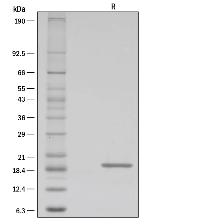 Recombinant Human Lymphotoxin-alpha/TNF-beta Protein, CF (211-TBB/CF ...