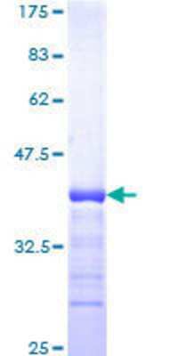 Recombinant Human RB associated KRAB repressor GST (N-Term) Protein ...