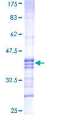 RNF212: Proteins and Enzymes | Bio-Techne