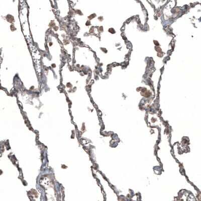 uPAR Antibody - BSA Free (NBP2-14711) by Novus, Part of Bio-Techne