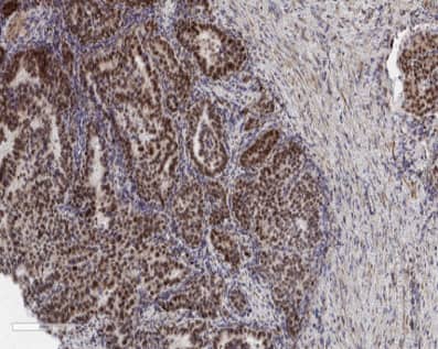 Rabbit VisUCyte HRP Polymer-DAB Cell & Tissue Staining Kit (VCTS003B ...